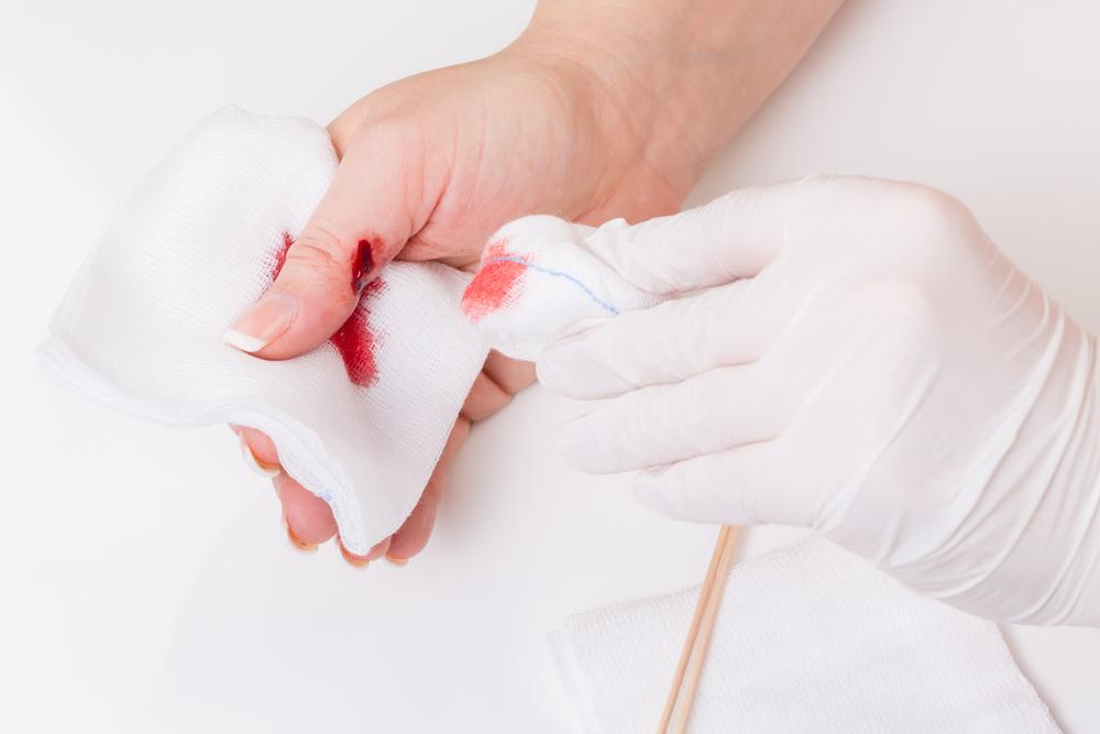 When Are Stitches Required For A Cut? - Right Choice Urgent Care